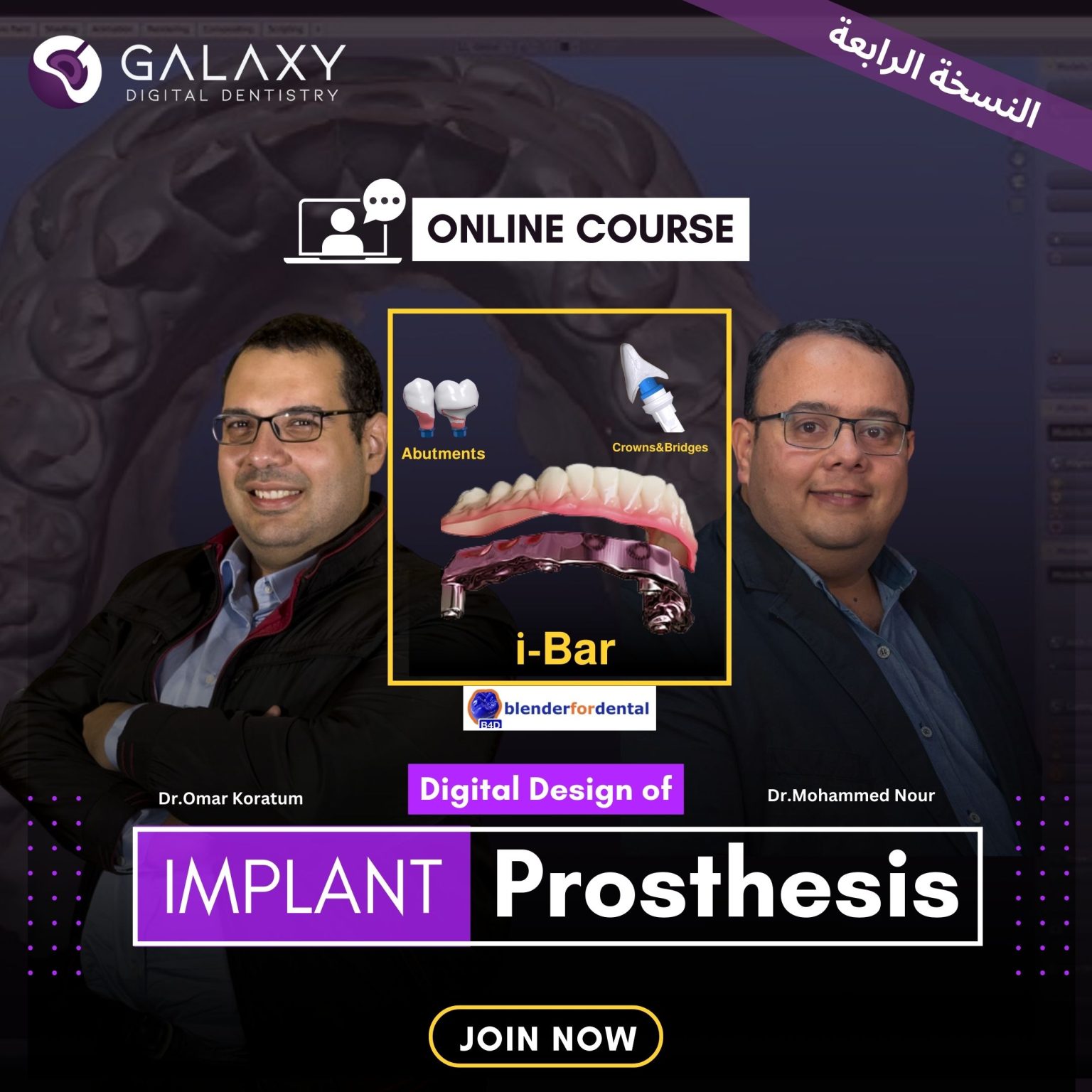 Master I-Bar Design in 3 Days - B1 - Galaxy Digital Dentistry